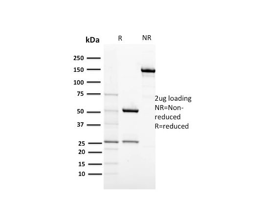 85-1289-34 CD117 / c-Kit （Marker for Gastrointestinal Stromal Tumors ...