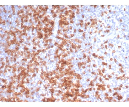 85-1291-73 CD3e （T-Cell Marker） 100ug 916-RBM17-P1 【AXEL】 アズワン