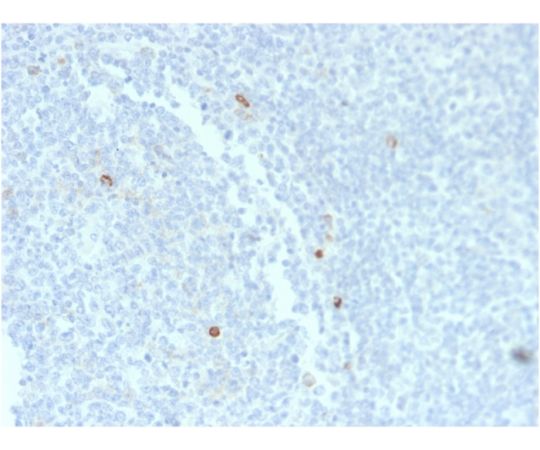 85-1294-55 IgM （Immunoglobulin Mu Heavy Chain） （B-Cell Marker） 100ug ...