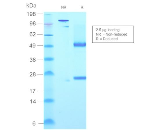 85-1300-07 IgM （Immunoglobulin Mu Heavy Chain） （B-Cell Marker） 100ug ...