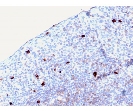 85-1300-07 IgM （Immunoglobulin Mu Heavy Chain） （B-Cell Marker） 100ug ...
