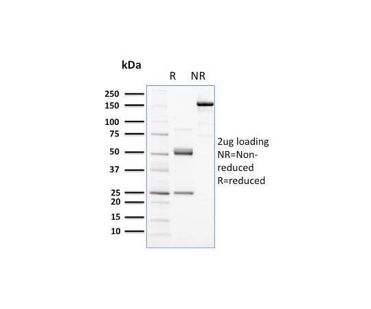 85-1300-17 CD117 / c-Kit （Marker for Gastrointestinal Stromal Tumors ...