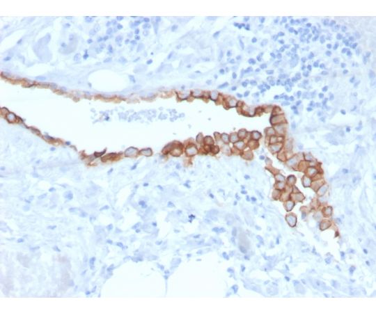 85-1307-47 Mesothelin （Mesothelial Marker） 100ug 10232-MSM4-P1 【AXEL】 アズワン