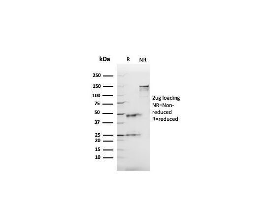 85-1307-65 Angiotensin I Converting Enzyme （ACE） / CD143 100ug 1636 ...