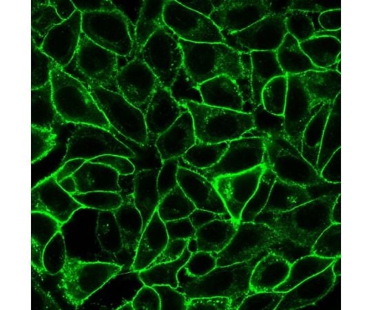 Endoglin / CD105（Angiogenesis Marker） 2022-MSMシリーズ NeoBiotechnologies ...