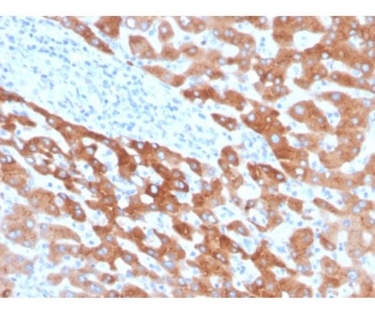 RBP4 / Retinol Binding Protein 4 5950シリーズ NeoBiotechnologies 【AXEL】 アズワン