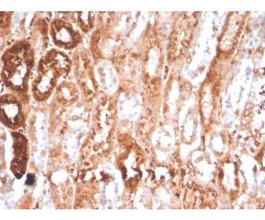 85-1312-90 RBP4 / Retinol Binding Protein 4 100ug 5950-MSM1-P1 【AXEL】 アズワン