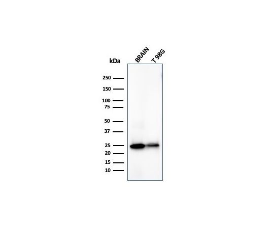 85-1318-44 PGP9.5 / UchL1 （pan-Neuronal Marker） 20ug 7345-MSM8-P0 【AXEL ...