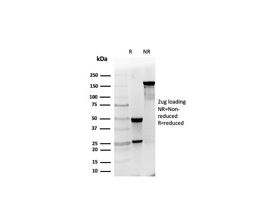 85-1318-44 PGP9.5 / UchL1 （pan-Neuronal Marker） 20ug 7345-MSM8-P0 【AXEL ...