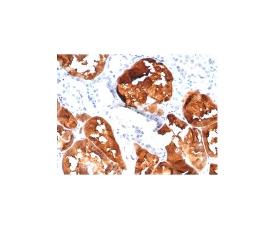 85-1319-91 Fatty Acid Binding Protein （Liver） / FABP1 100ug 2168-MSM5 ...