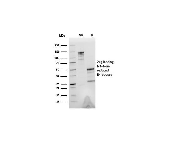 Tubulin beta 3 / TUBB3（Neuronal＆ Stem Cell Marker） 10381-MSM2-Pシリーズ ...