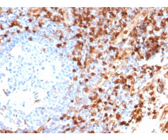 85-1306-85 Annexin A1 / （Hairy Cell Leukemia Marker） 20ug 301-MSM8-P0 ...