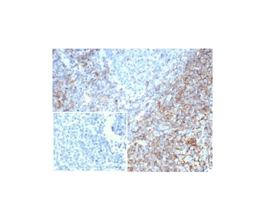 85-1326-21 CD35 / CR1 （Follicular Dendritic Cell Marker） 100ug 1378 ...