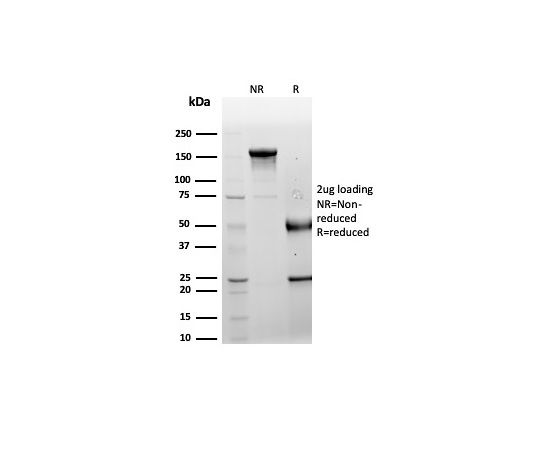 LRG1 / Leucine Rich alpha-2-glycoprotein 1 116844-MSMシリーズ ...