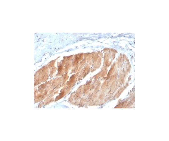 85-1332-62 PIK3R2 （Phosphoinositide-3-kinase regulatory subunit 2） 20ug ...