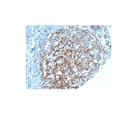 85-1334-01 CD35 / CR1 （Follicular Dendritic Cell Marker） 100ug 1378 ...